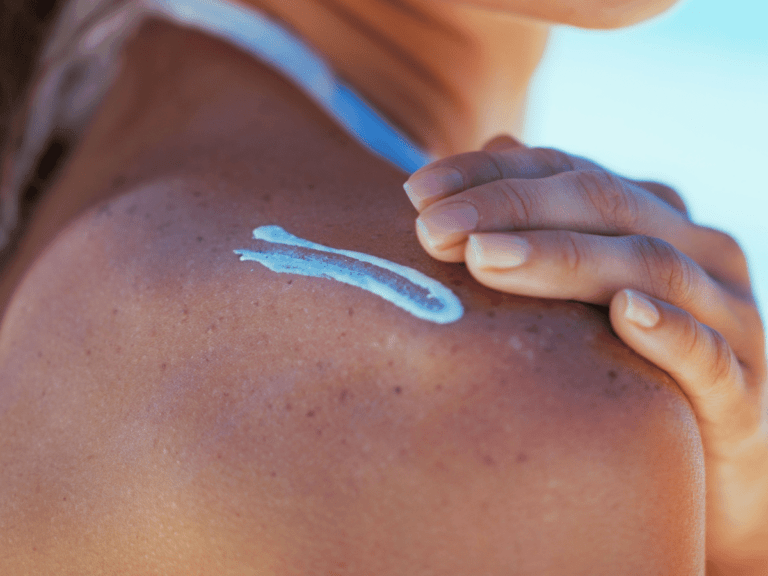 5 Types of Warts to Know